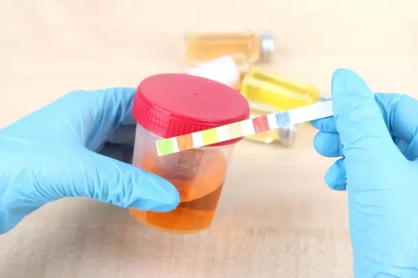 Urine Bile salt and pigment – Alaknanda Diagnostic Lab